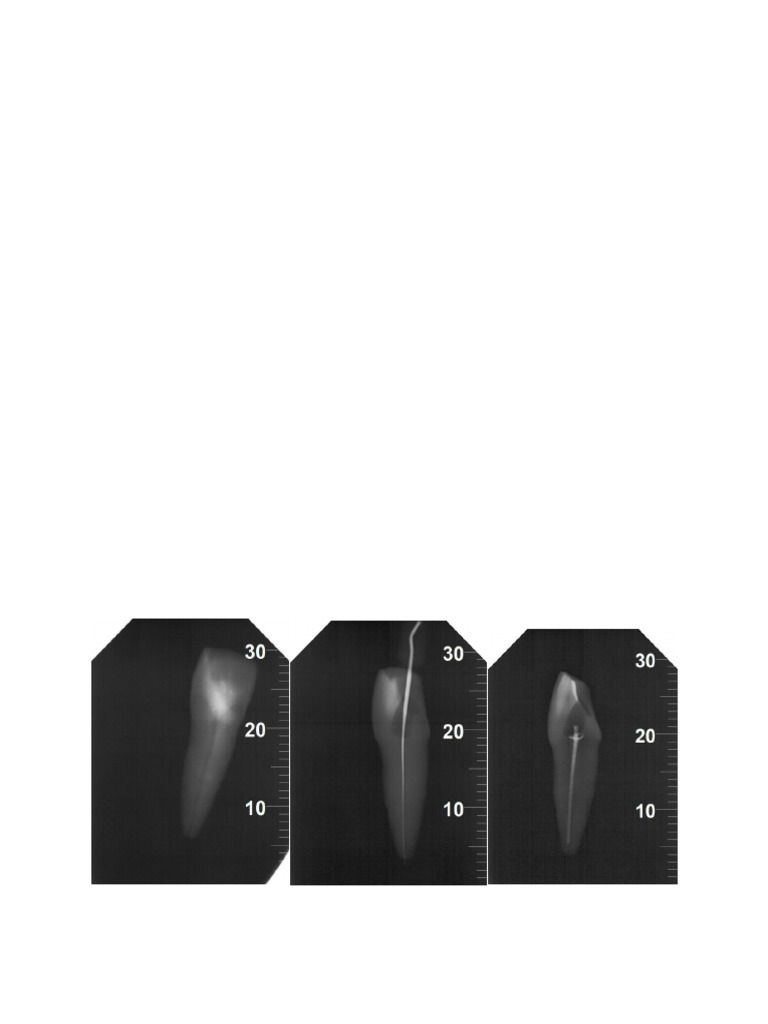 Endo | PDF