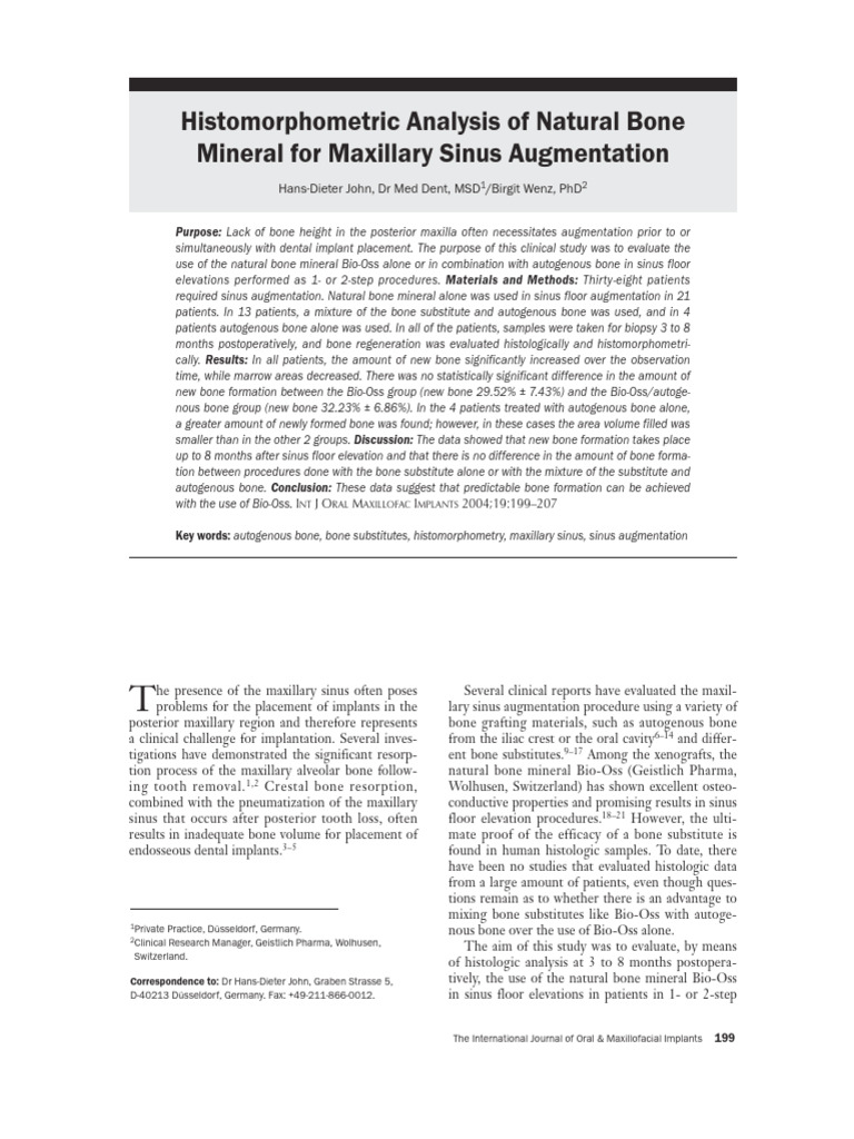 John - Histomorphometric Analysis of Natural - 2004 | PDF | Dental Implant