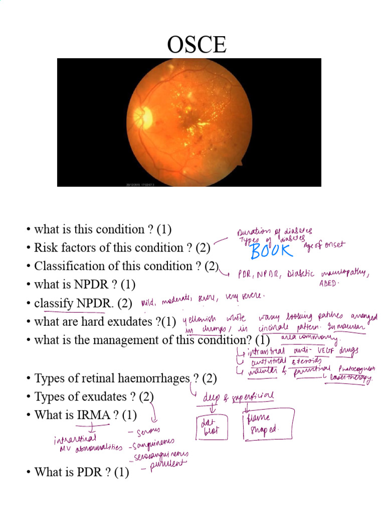 OSCE 2 | PDF | Cataract | Diseases And Disorders