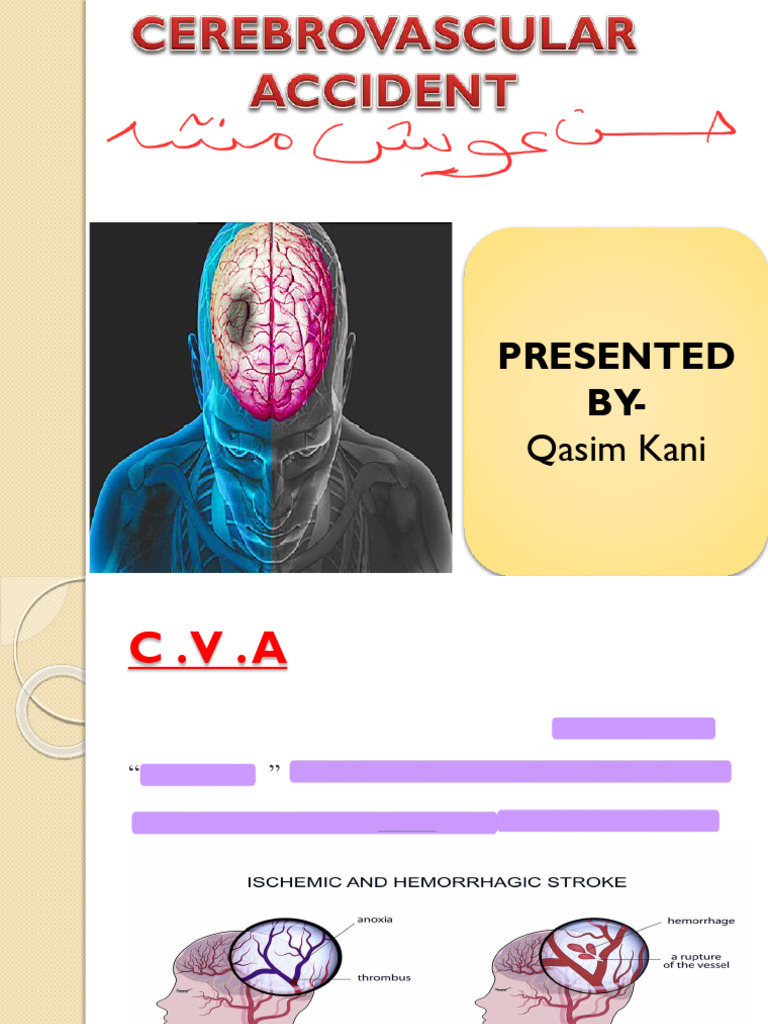 الطب الباطني النظري 4 | PDF | Stroke | Thrombosis