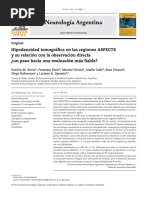 Escala ASPECTS | PDF