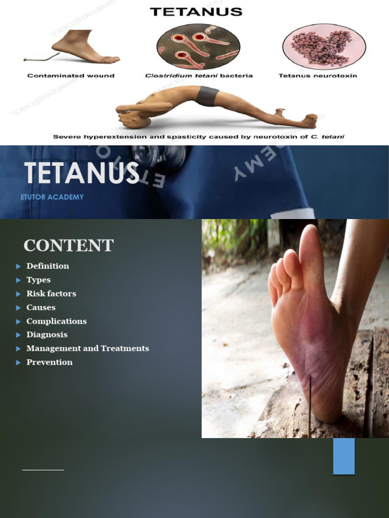 tetanus etutor academy | PDF | Immunology | Medical Specialties