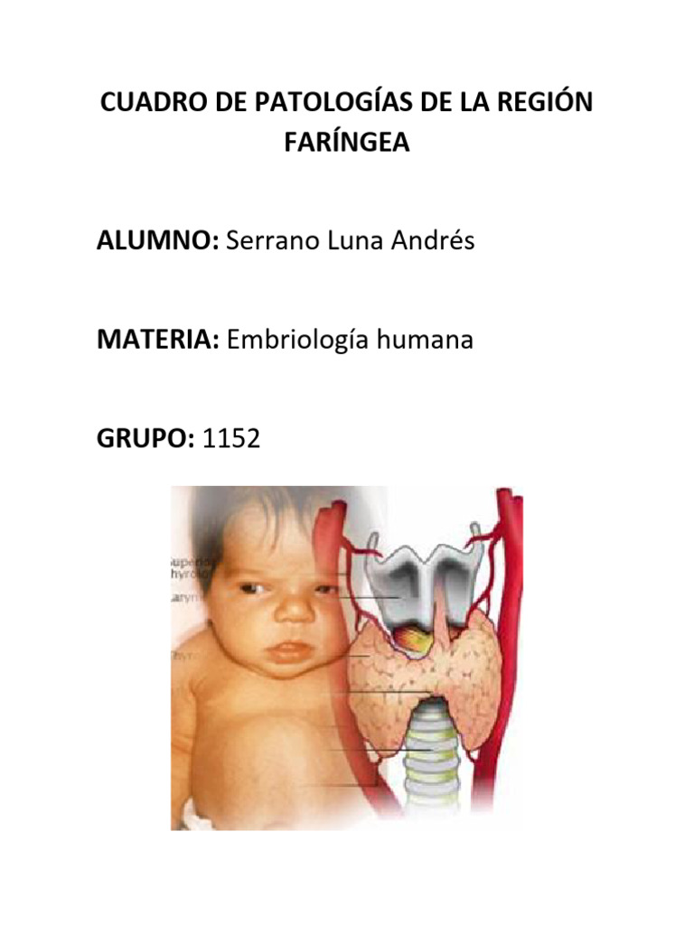 Patologías de la Región Faríngea | PDF