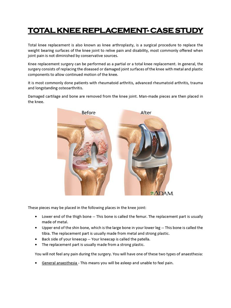 Total Knee Replacement | PDF | Knee | Foods
