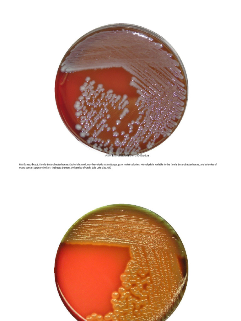 Enterobacteriaceae Colony Characteristics | PDF