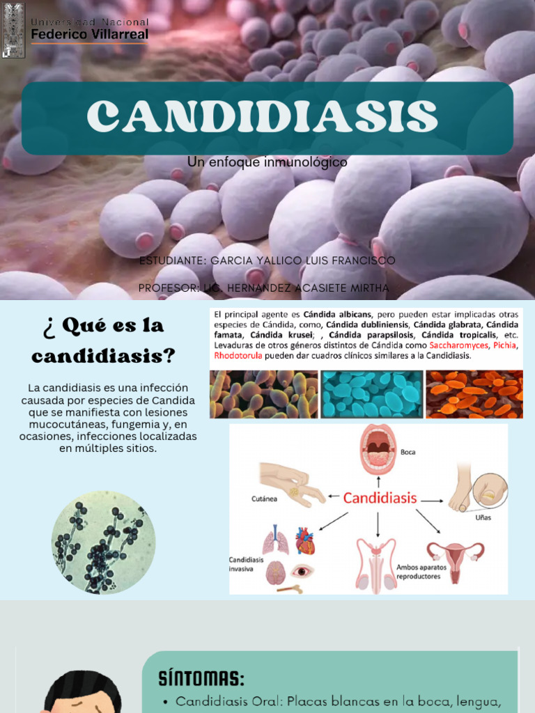 Candidiasis | PDF | Sistema inmune | Candidiasis