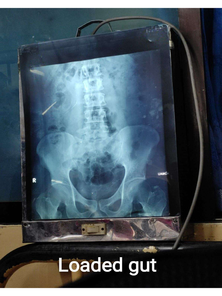 Surgery X-Ray | PDF