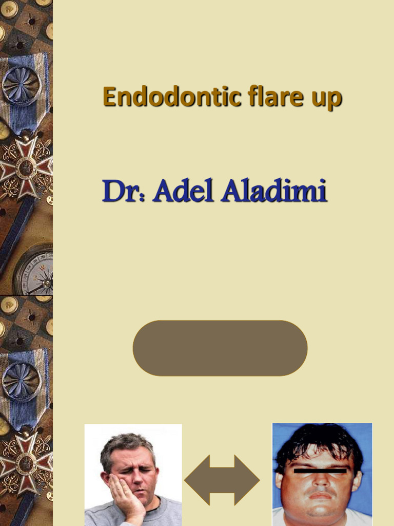 Endodontic Flare-Ups: Causes and Management | PDF | Diseases And ...