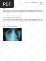 Simulado Asma Questoes | PDF | Asma | Bronquite