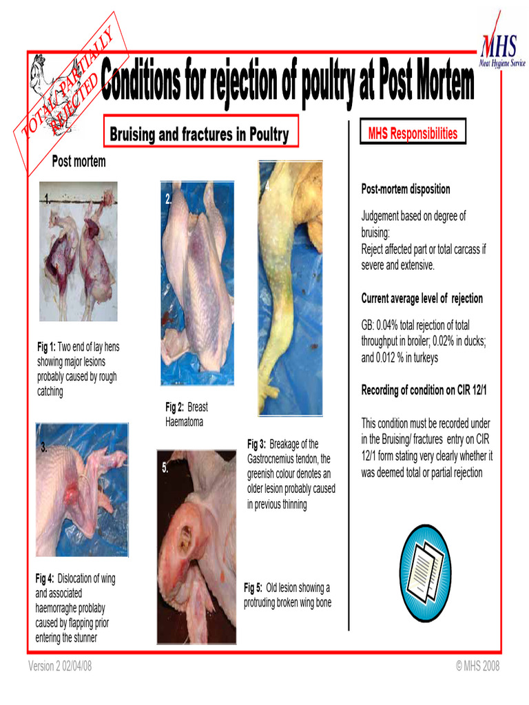 Brusing and Fractures V 2 02-04-08 | PDF | Diseases And Disorders ...