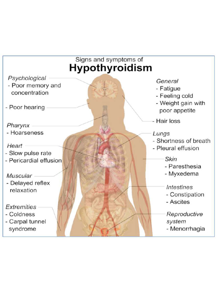 Signs and Symptoms of Hypothyroidism | PDF