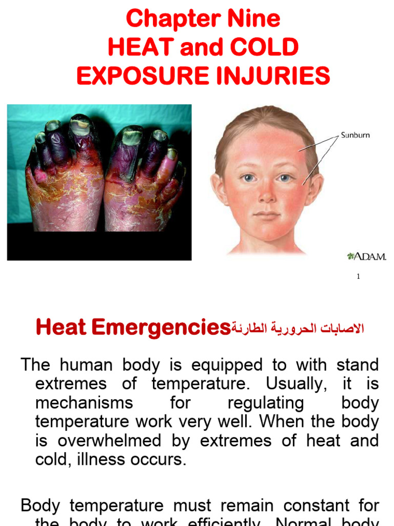 Chapter 9 - 9yh | PDF | Hypothermia | Hyperthermia