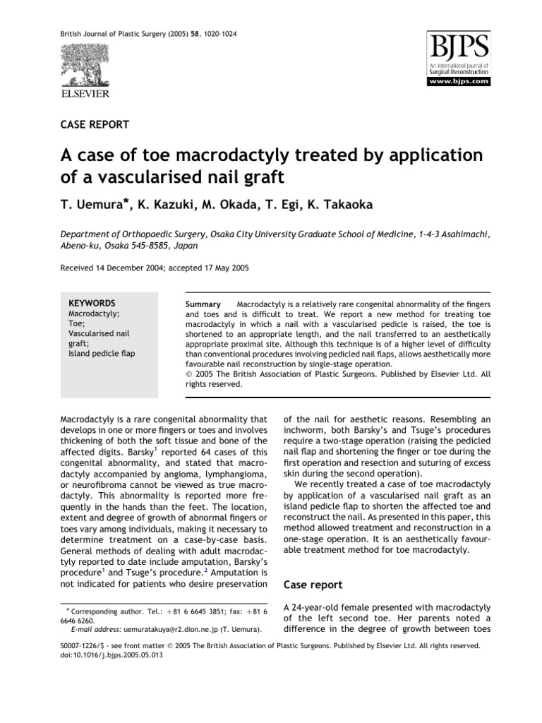 A Case of Toe Macrodactyly Treated by Application | PDF | Toe | Foot