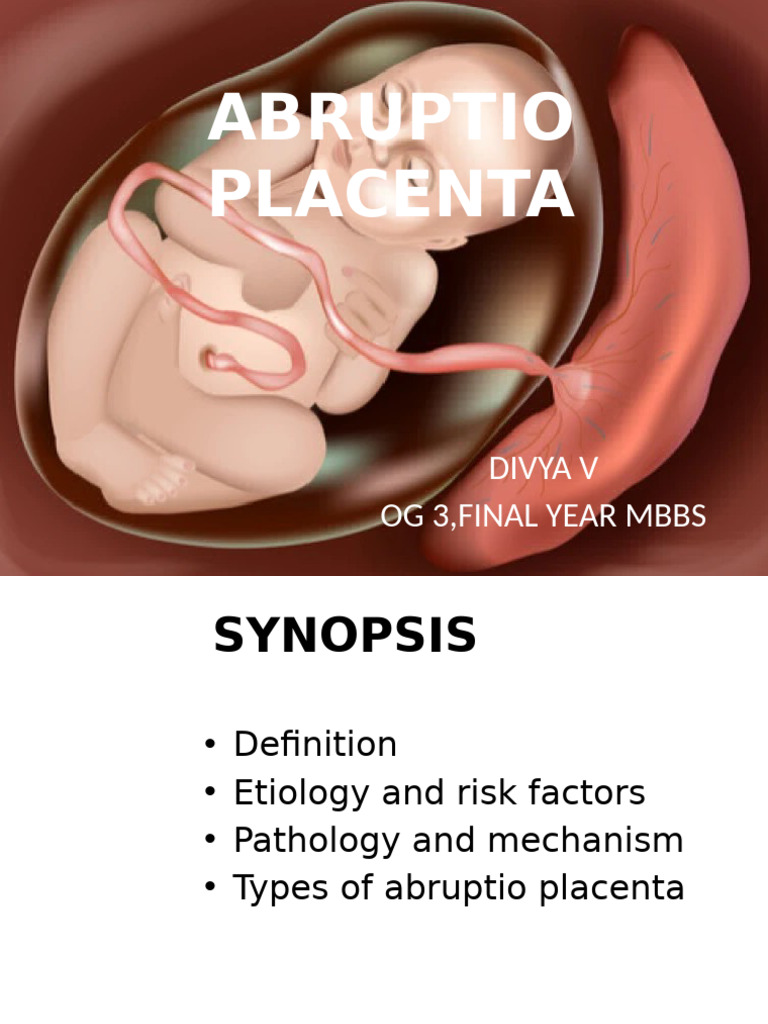 Abruptio Placenta Final | PDF