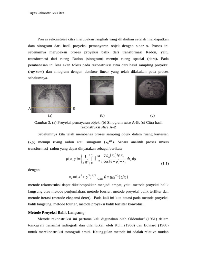 Metode Rekontruksi Ct-Scan | PDF