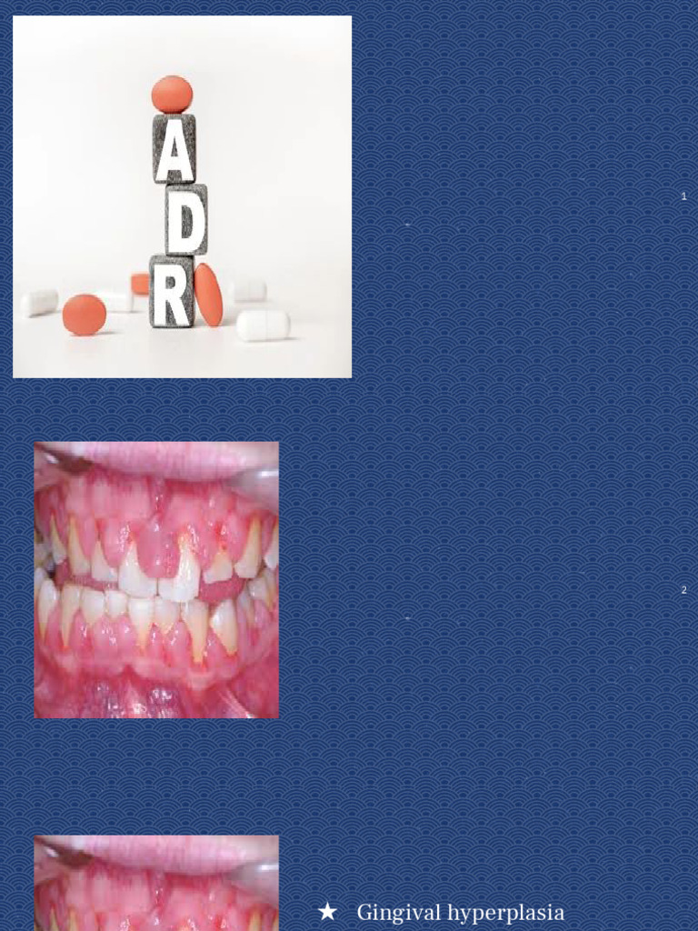 adr | PDF | Drugs | Pharmacology