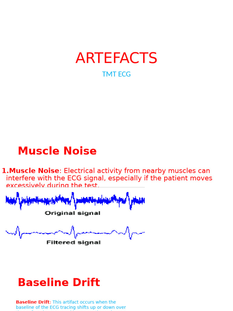 Artefactsin Ecg TMT | PDF