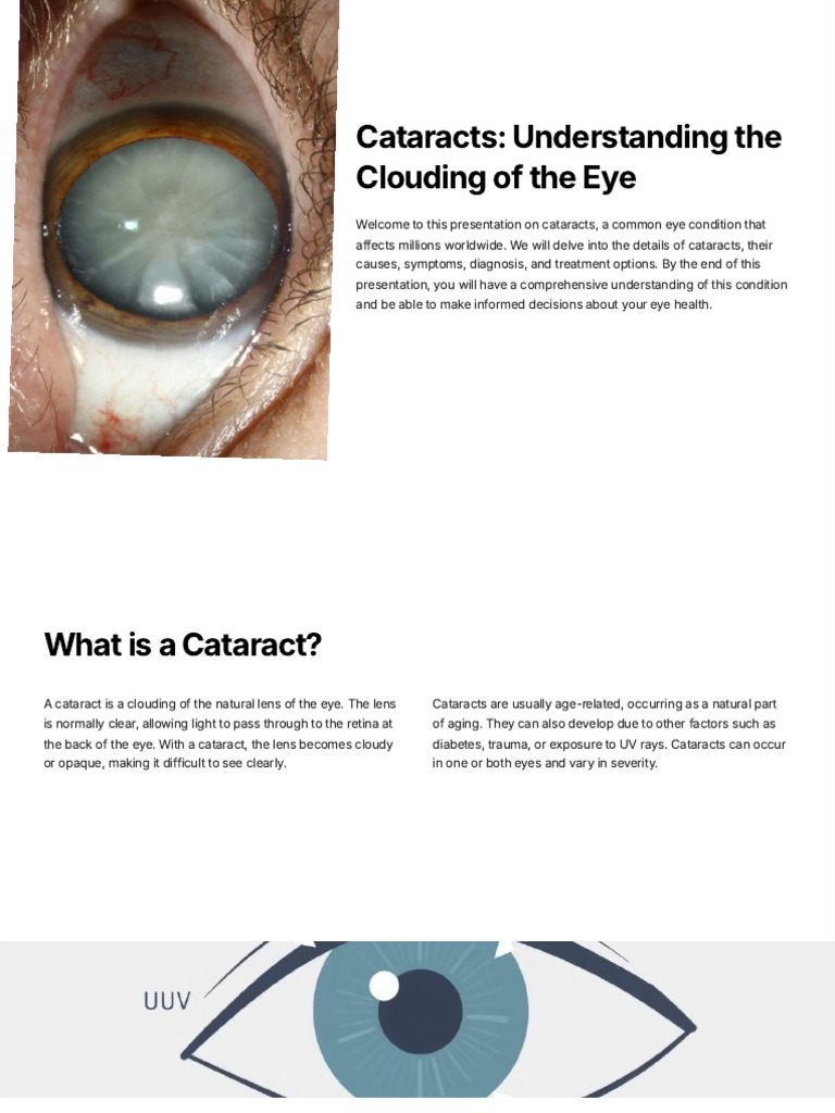 Understanding Cataracts and Their Types | PDF | Cataract | Eye