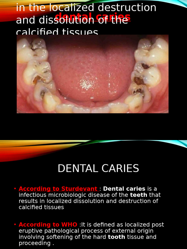 Understanding Dental Caries Factors | PDF | Medical Specialties ...