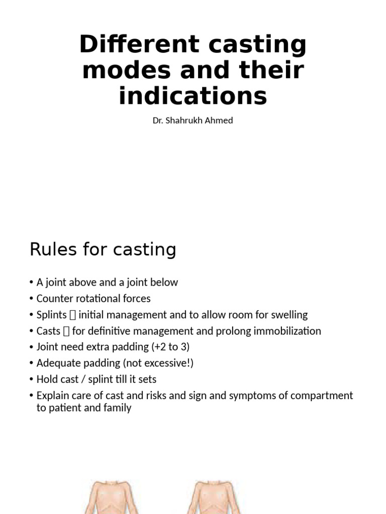 Casting Modes N Indications - 024927 | PDF