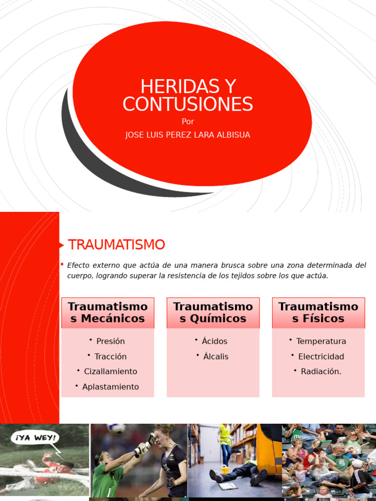 contusiones y heridas | PDF | Edema | Herida