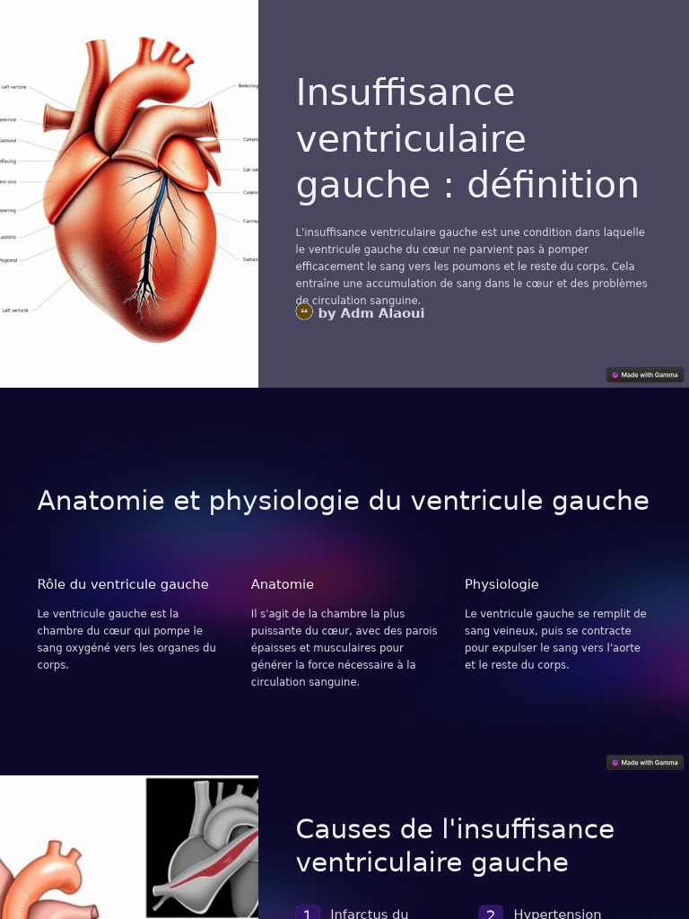 Insuffisance Ventriculaire Gauche Definition | PDF