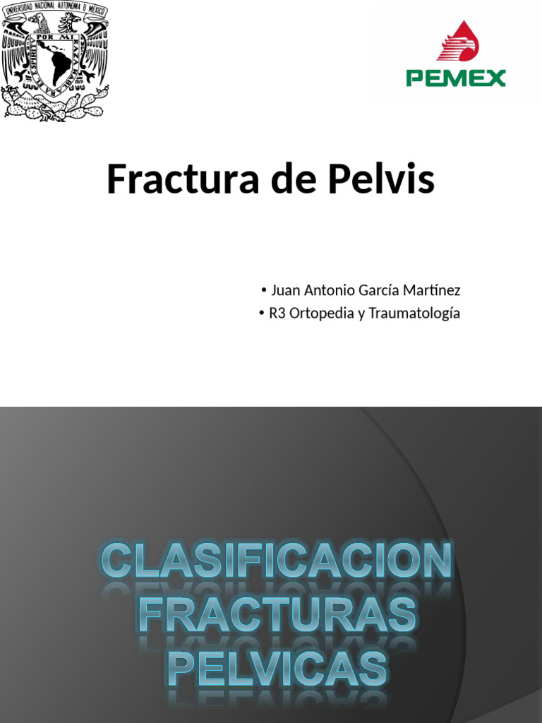 fractura de pelvis | PDF | Pelvis | Sistema musculoesquelético