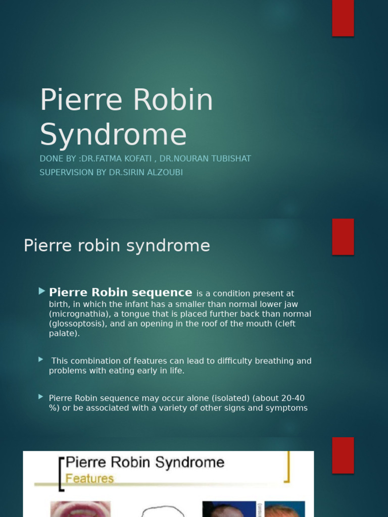 Understanding Pierre Robin Syndrome | PDF | Diseases And Disorders ...