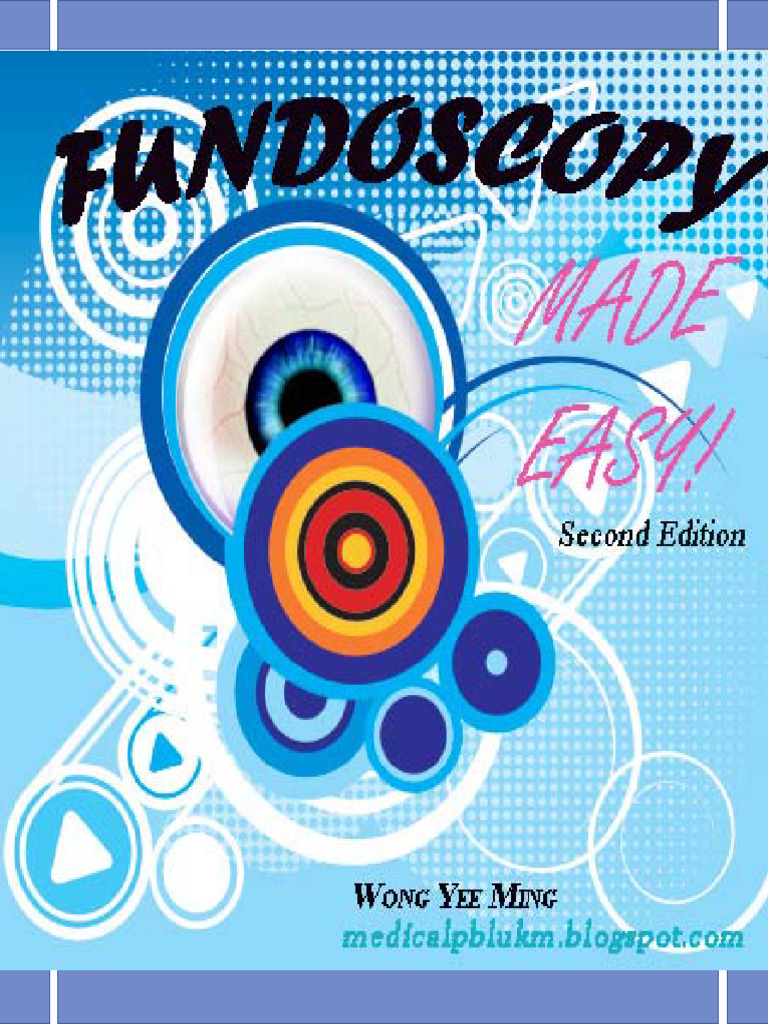 Fundoscopy MADE EASY 2nd Edition | PDF | Retina | Vein