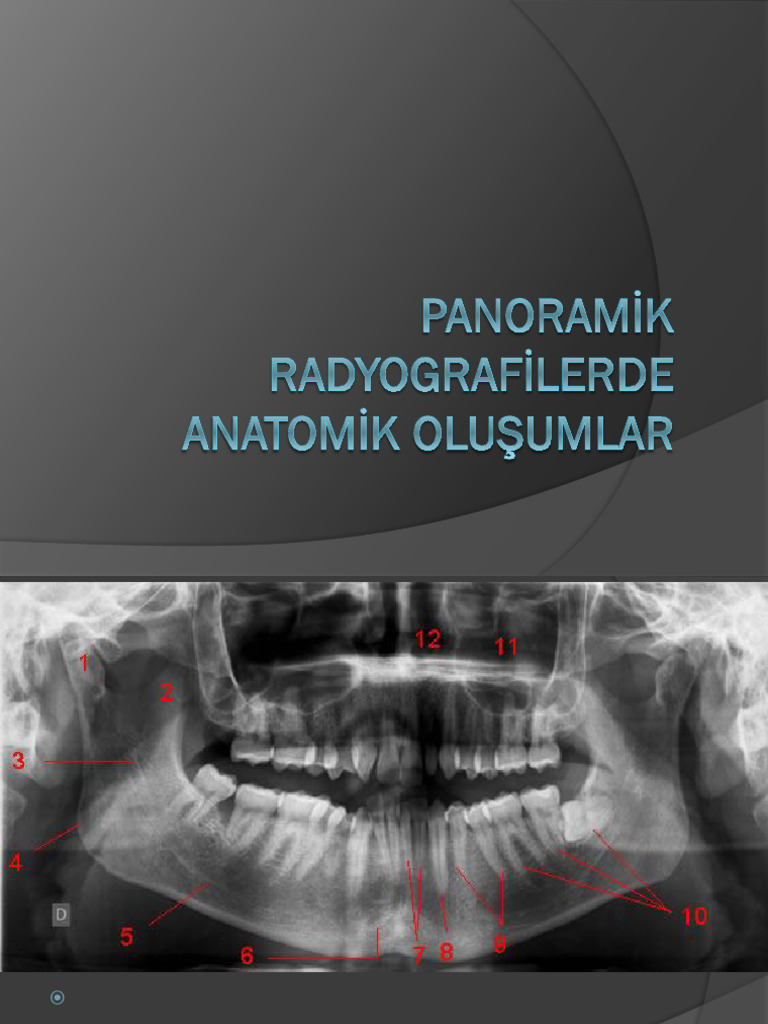 Panoramic Radiography | PDF