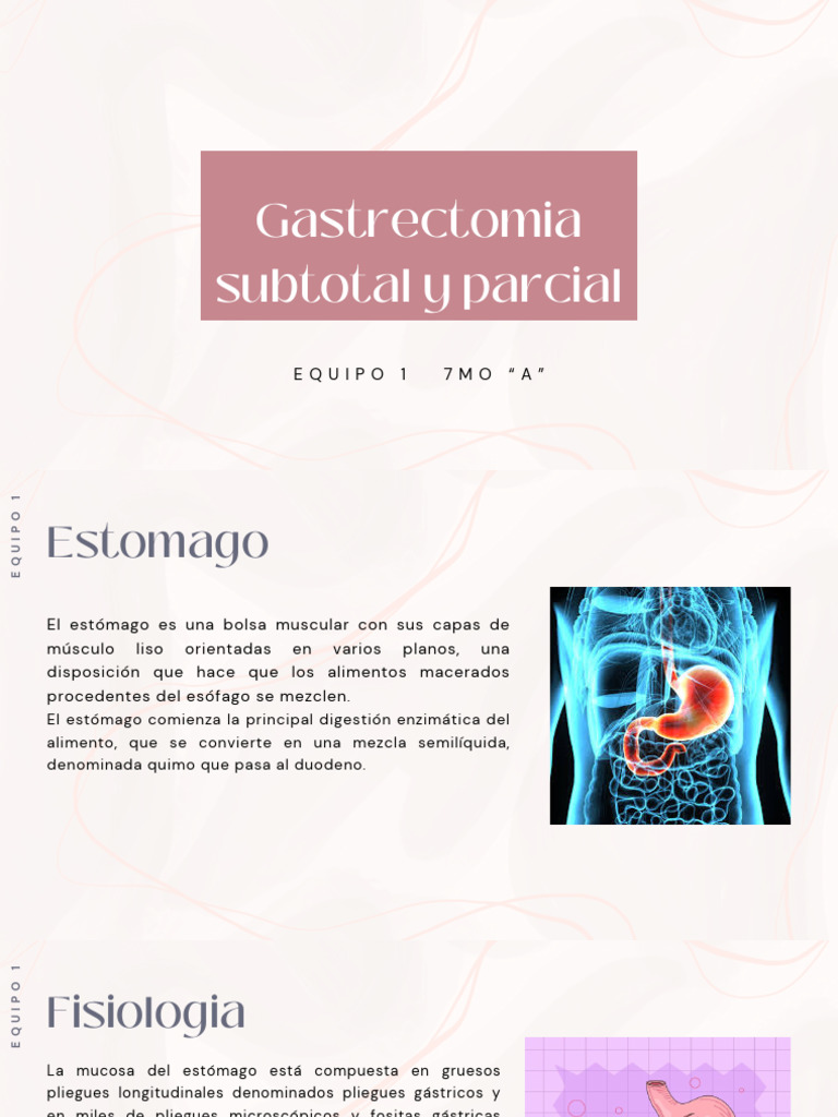 Gastrectomia Subtotal y Parcial | PDF | Estómago | Órgano (anatomía)