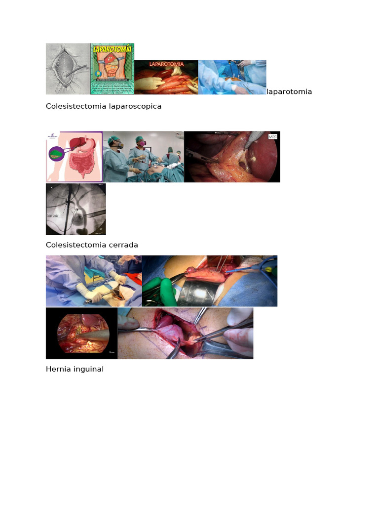 Procedimiento Quirúrgico Laparotomia Exploratoria Abierta | PDF