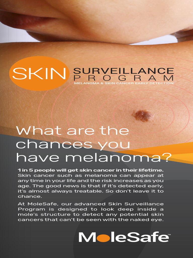 MoleSafe Web Brochure (1) | PDF | Melanoma | Skin Cancer