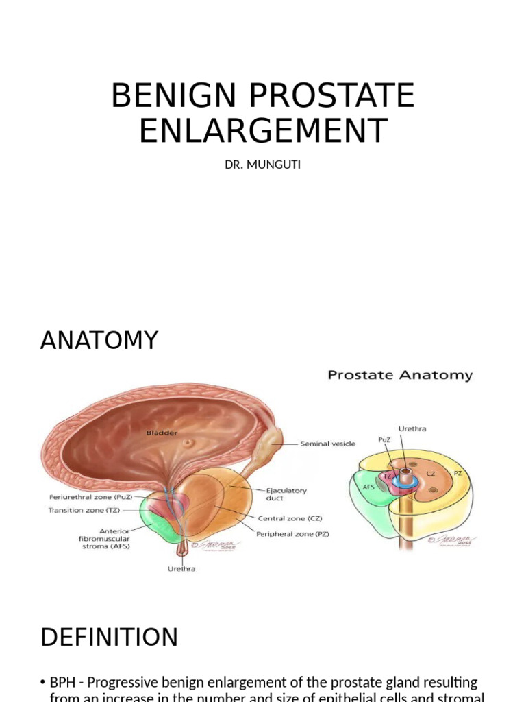 Bph | PDF | Prostate | Urinary Incontinence
