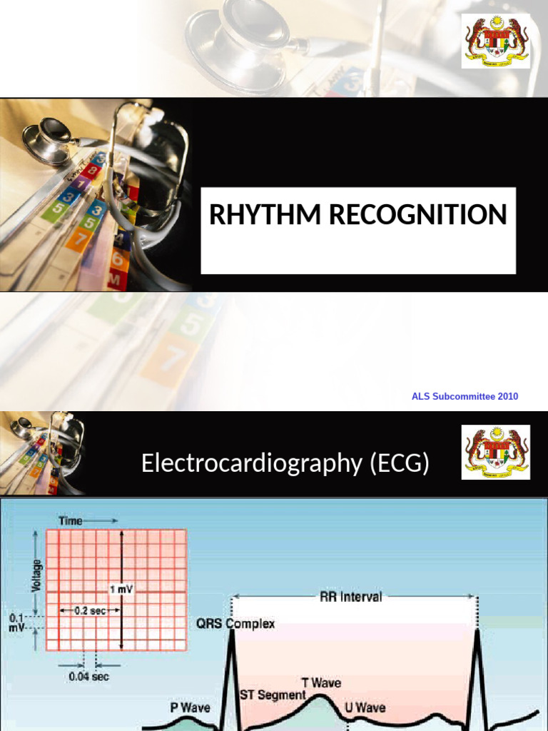 Rhythm Recognition | PDF