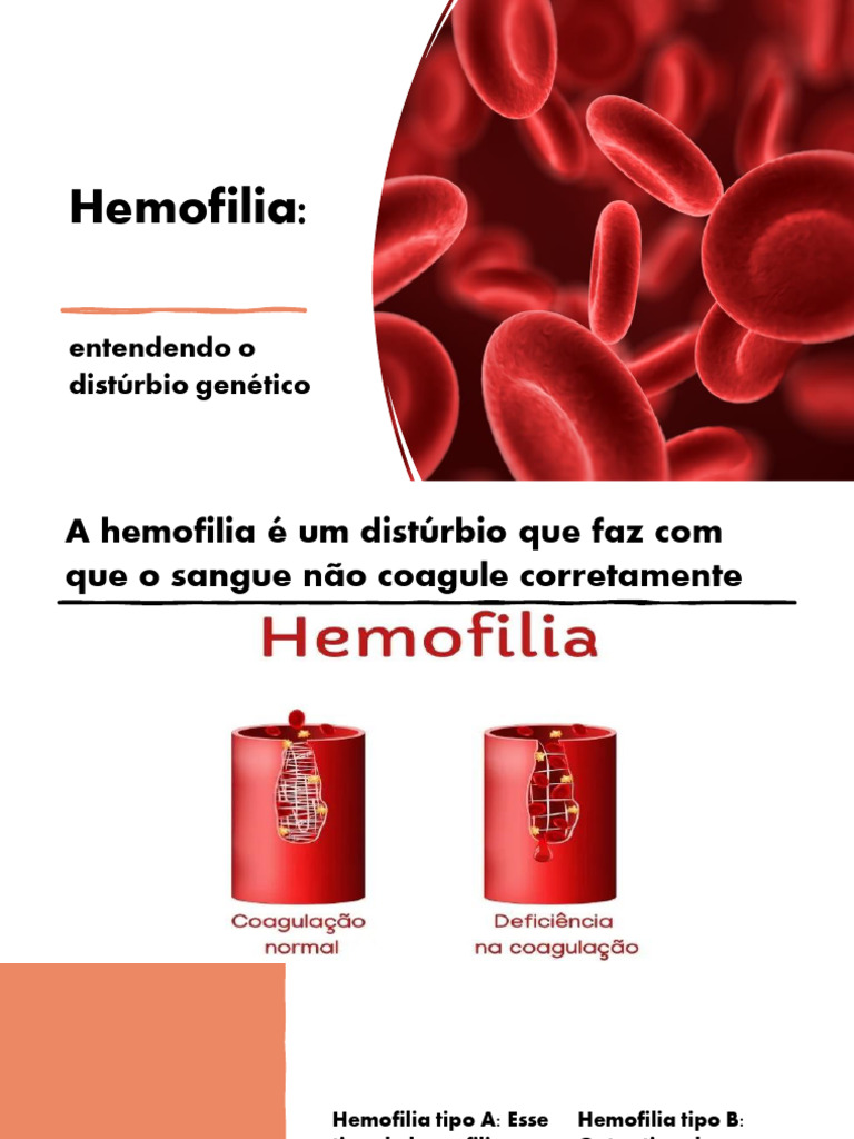 Hemofilia | PDF