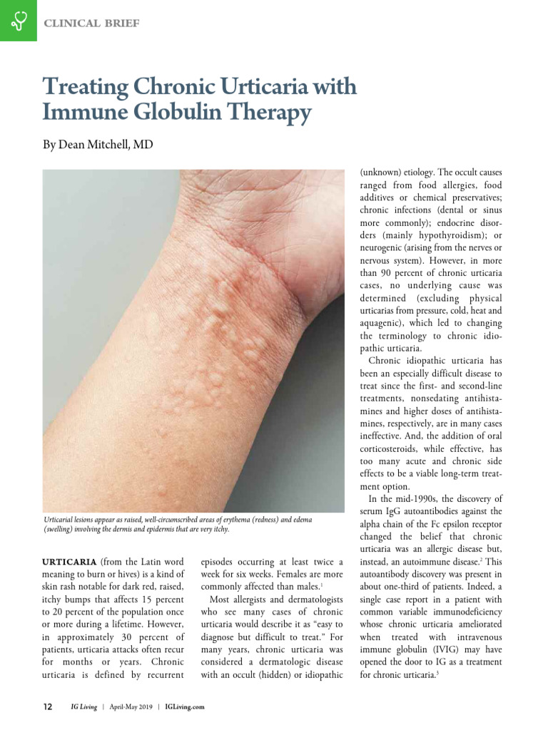 IGL - 2019 04 - AR - Clinical Brief Treating Chronic Urticaria With ...