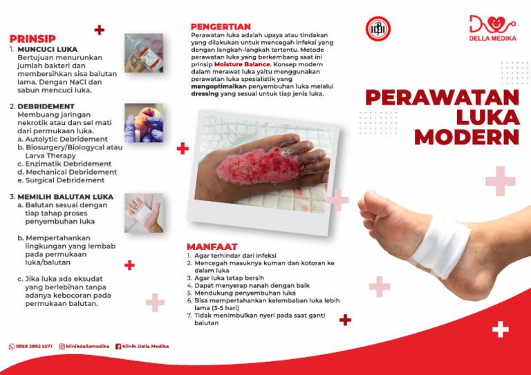 Perawatan Luka Modern untuk Penyembuhan Optimal | PDF
