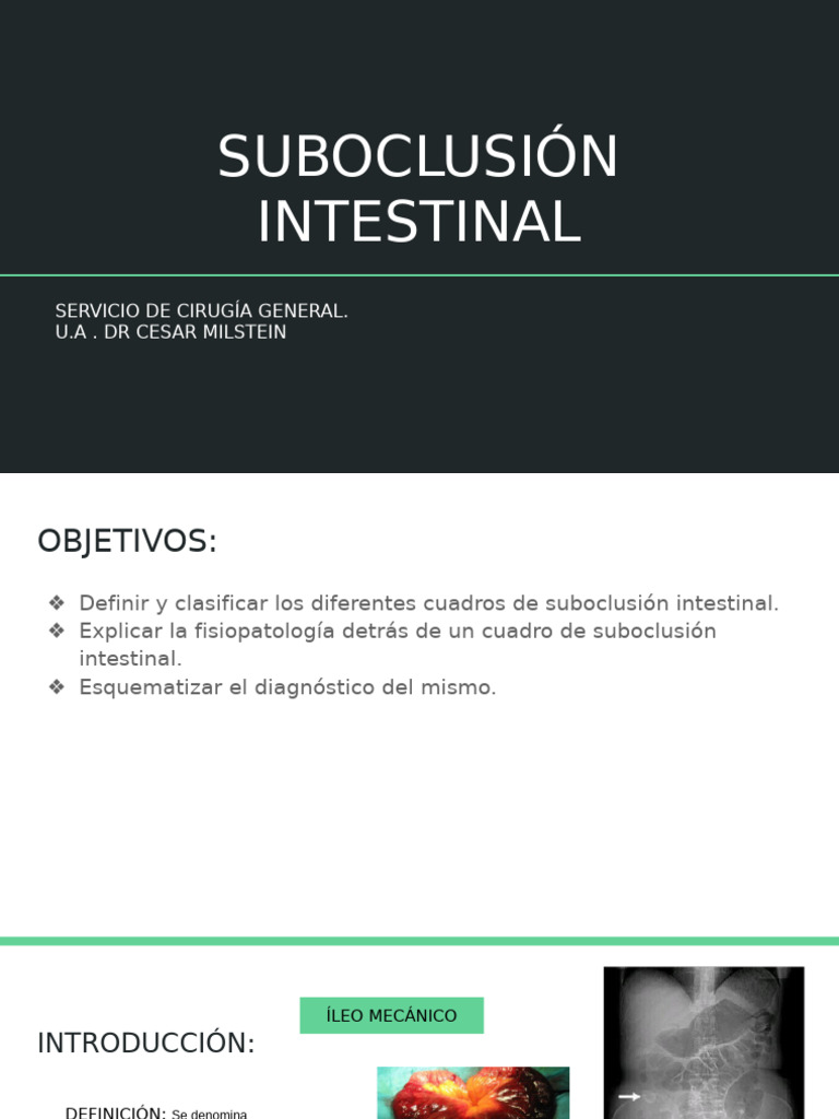 Suboclusion Intestinal | PDF | Enfermedades digestivas | Gastroenterología