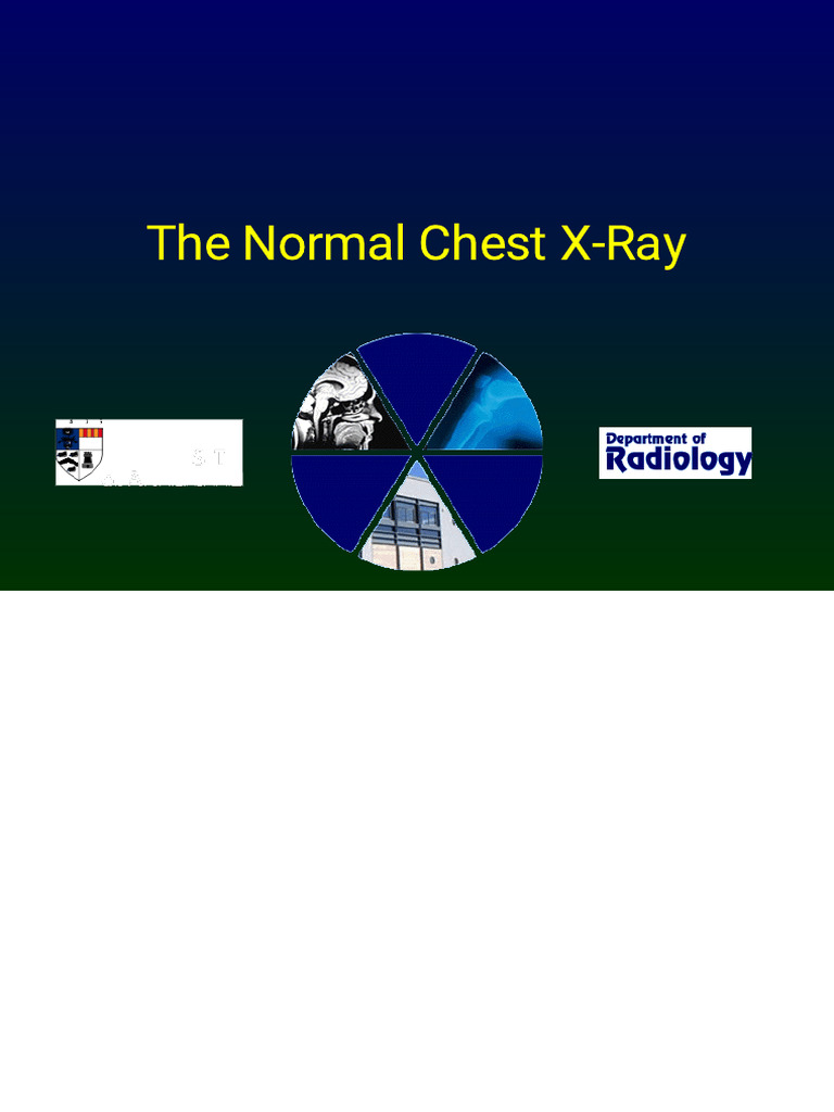 xray.... | PDF | Thorax | Thorax (Human Anatomy)