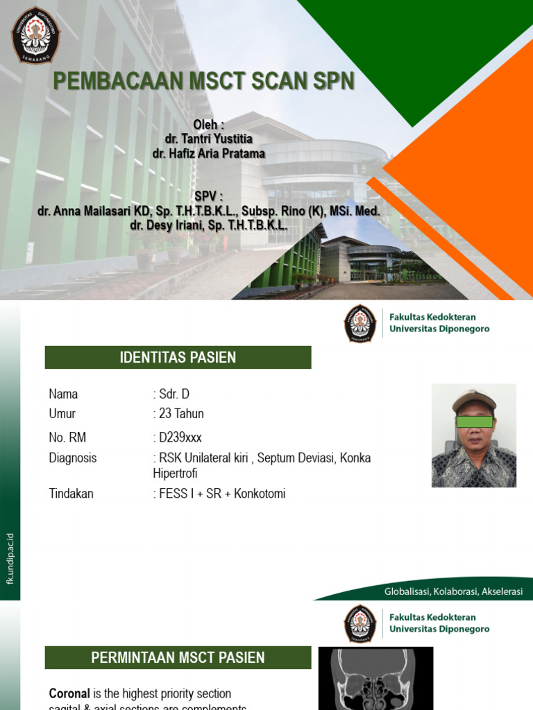 MSCT Scan SPN Tantri Hafiz Rino Dr. ANA Dr. DI | PDF | Surgical Specialties | Rhinology