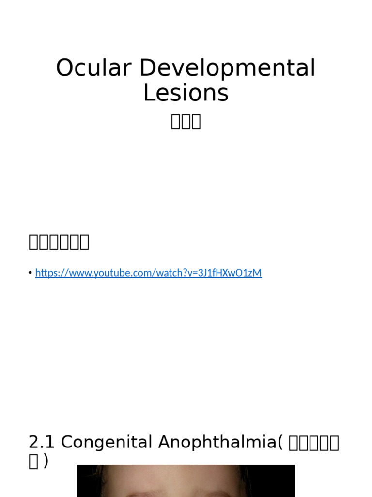 Lecture 6 | PDF | Human Eye | Ophthalmology