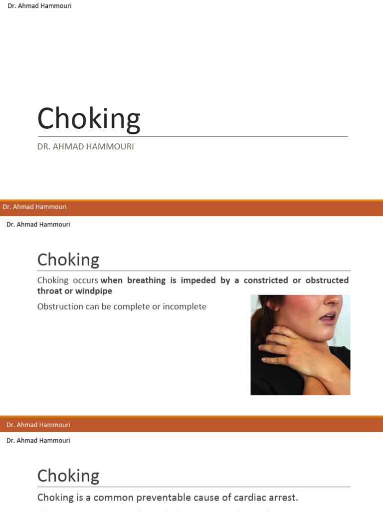 Lecture 4 _ Choking | PDF | Clinical Medicine | First Aid