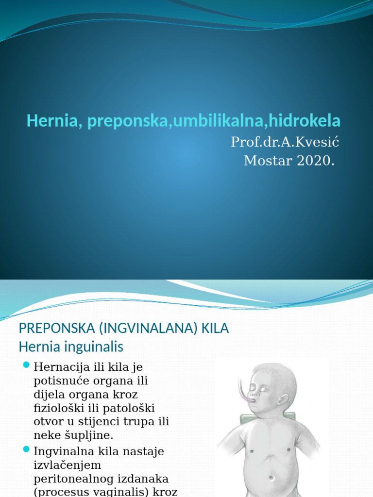 S4-1 - Preponska I Umbilikalna Kila, Kriptorhizam, Fimoza | PDF