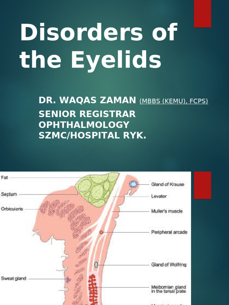 Eyelid Disorders | PDF | Medical Specialties | Causes Of Death