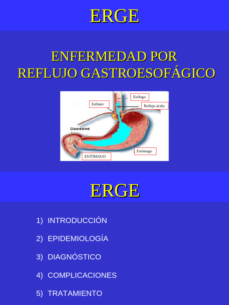 02 - ERGE Gastritis y Vómito (Dra Sosa) 05 - 08 - 20 | PDF | La enfermedad por reflujo ...