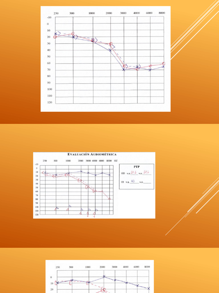 AUDIOGRAMAS (1) | PDF