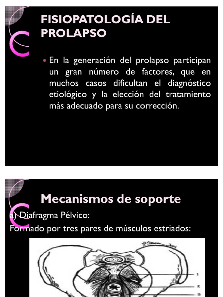 FISIOPATOLOGÍA DEL PROLAPSO | Vagina | Útero
