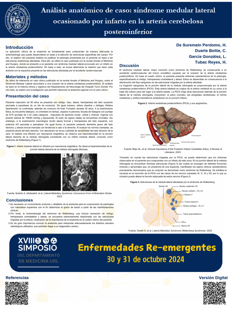 Análisis Anatómico Síndrome Medular Lateral Ocasionado Por Infarto en ...