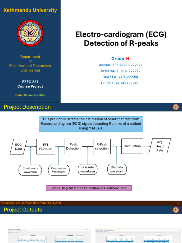 ECG R-Peak Detection Project Report | PDF | Electrocardiography ...
